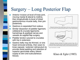Knee_Disarticulation.pdf fully described and explained | PDF