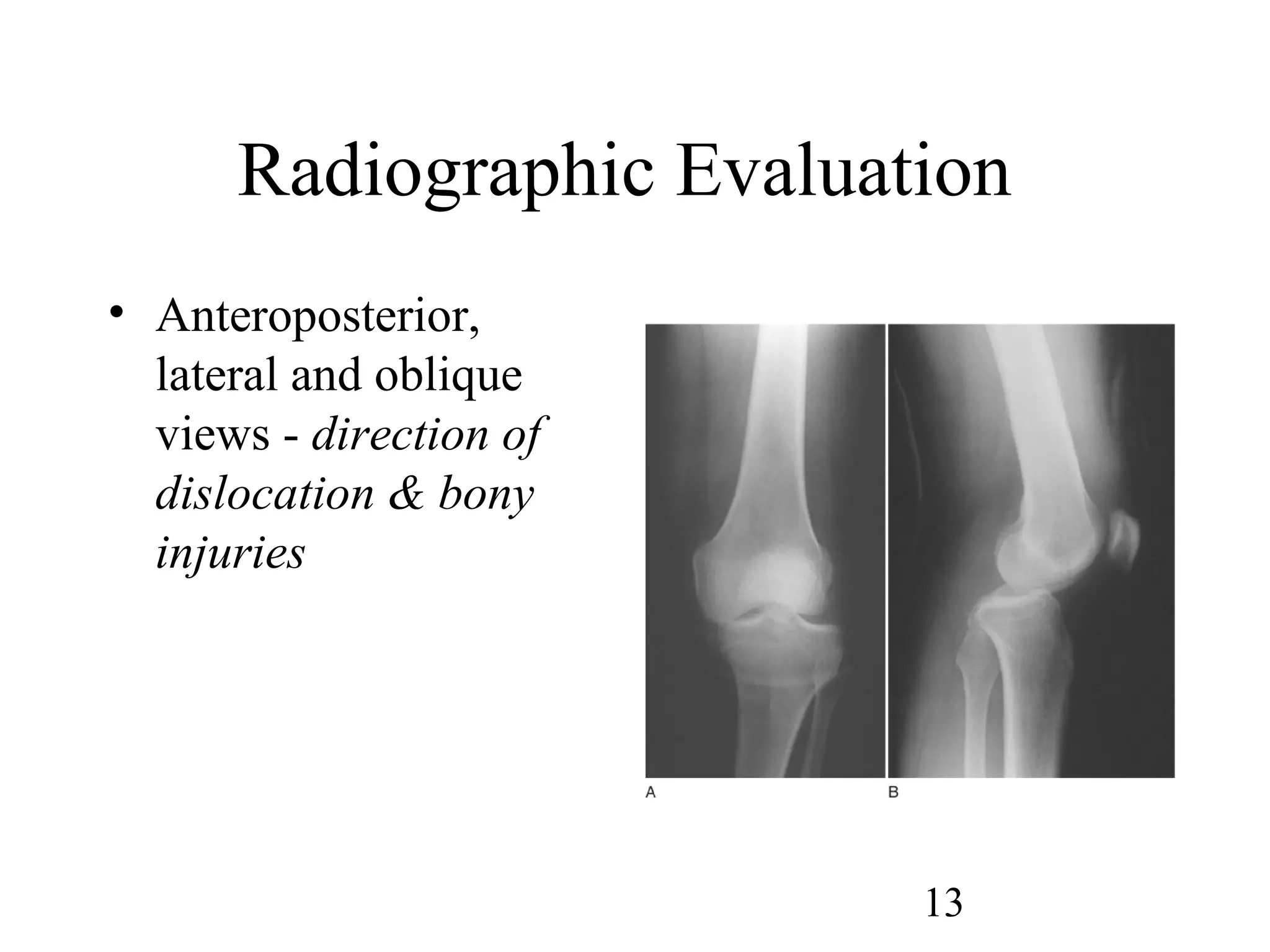 Knee dislocation | PPT