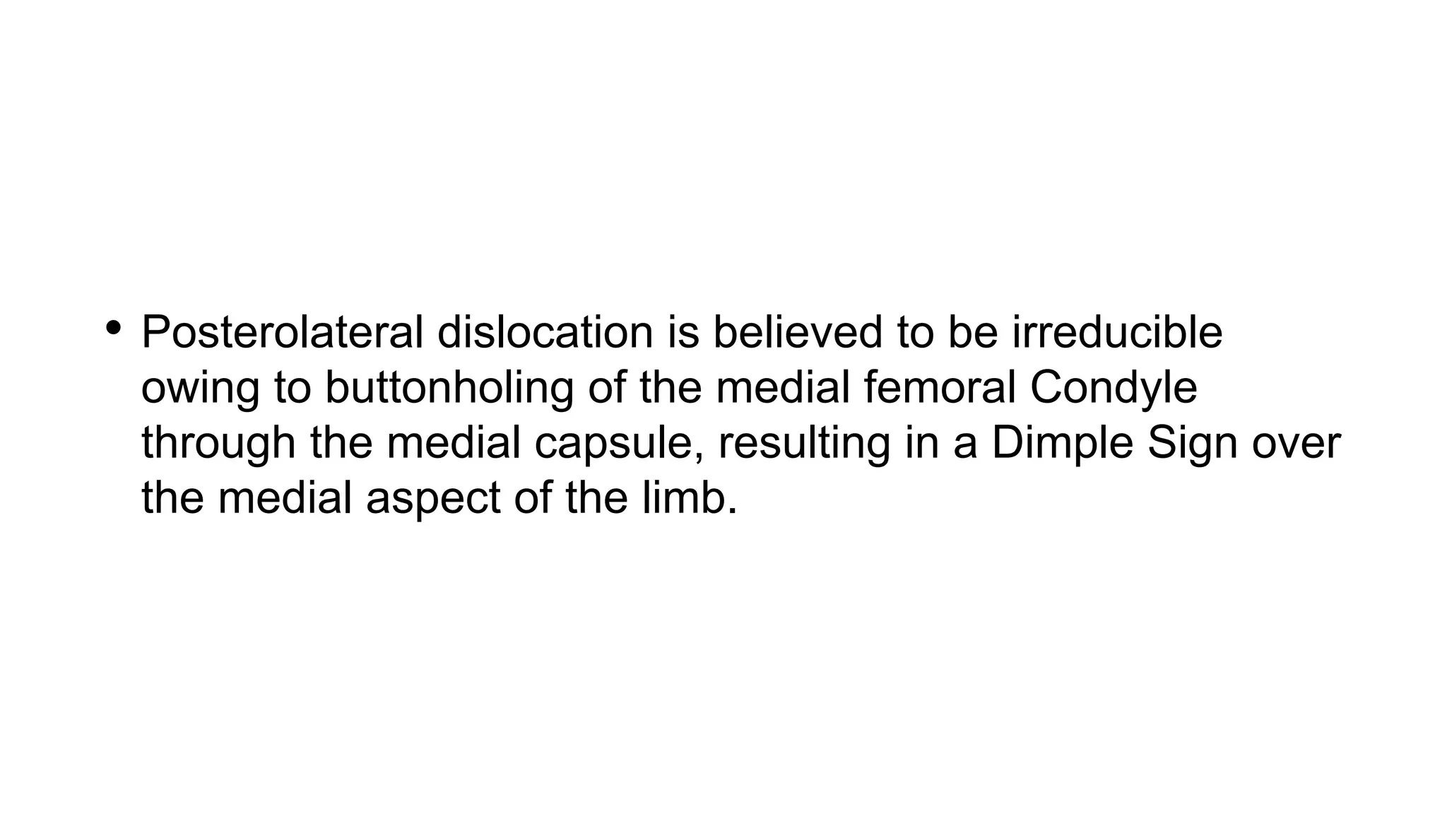 Knee dislocation | PPTX