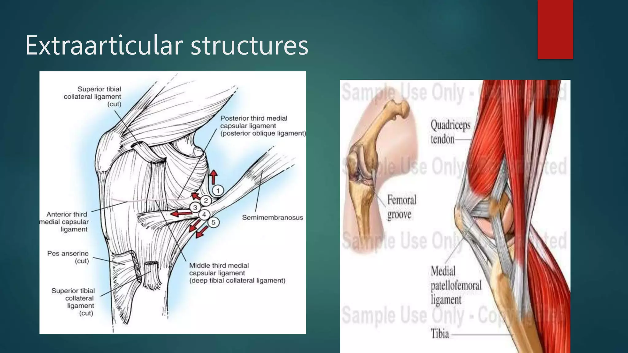 Knee dislocation.pptx