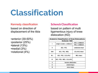 Knee dislocation ext ณัฐ | PPT
