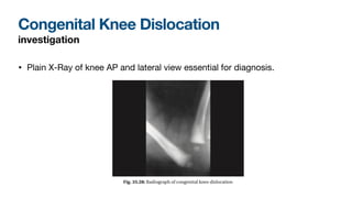 Knee Dislocation Orthopaedics MBBS Presentation | PDF