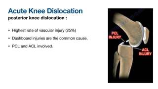 Knee Dislocation Orthopaedics MBBS Presentation | PPT