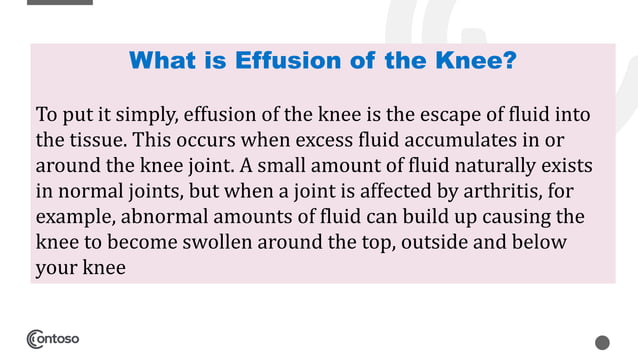 Knee effusion : Fluid Or Water On The Knee-Medical Study | PPTX
