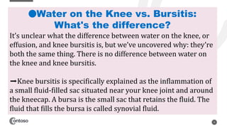 Knee effusion : Fluid Or Water On The Knee-Medical Study | PPTX