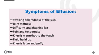 Knee effusion : Fluid Or Water On The Knee-Medical Study | PPTX