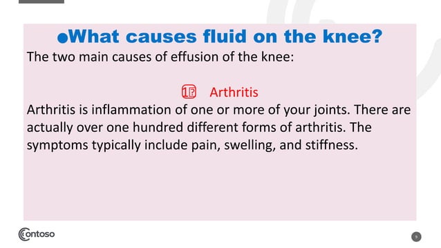 Knee effusion : Fluid Or Water On The Knee-Medical Study | PPTX