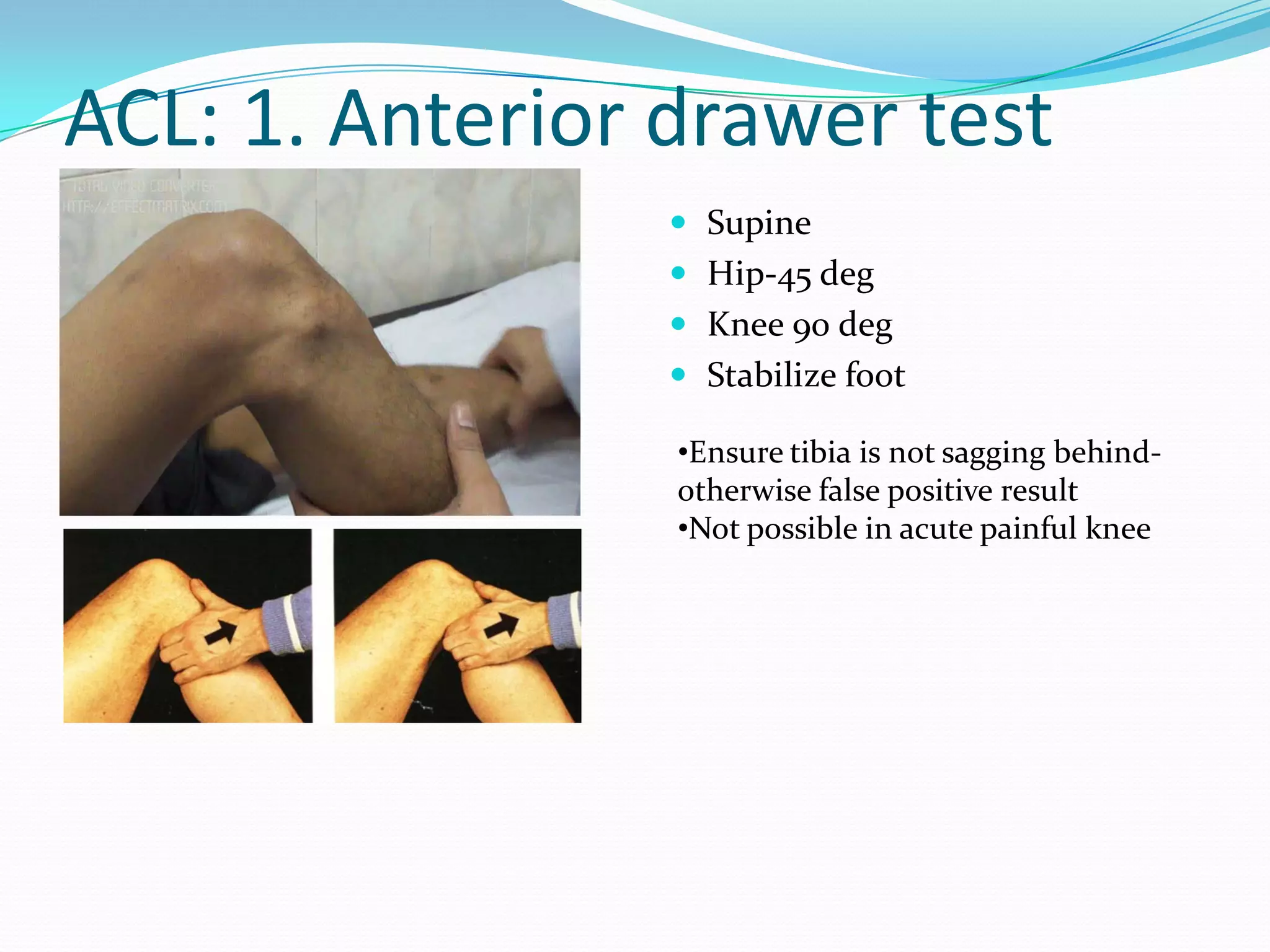 Knee examination | PDF