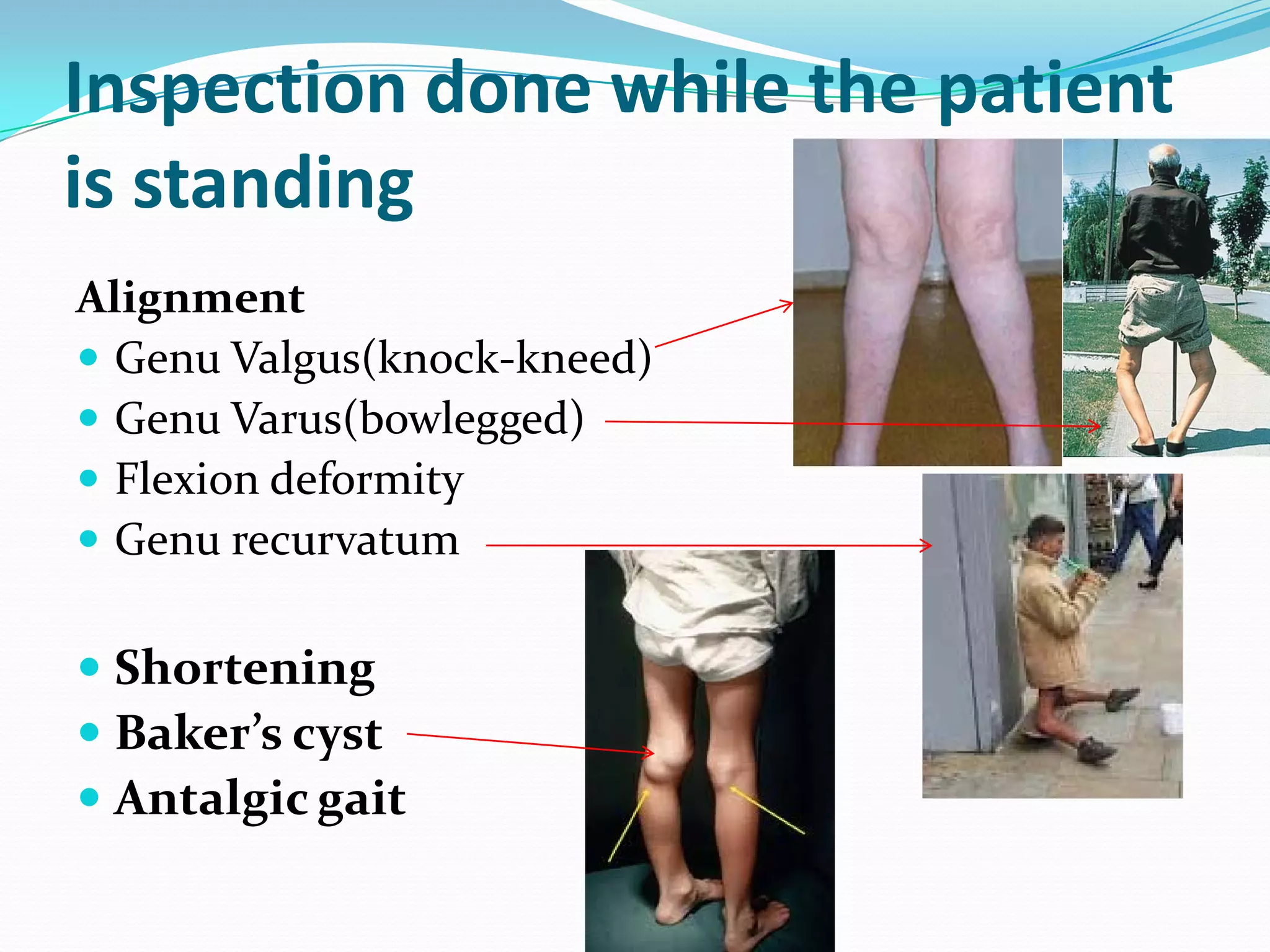 Knee examination | PDF