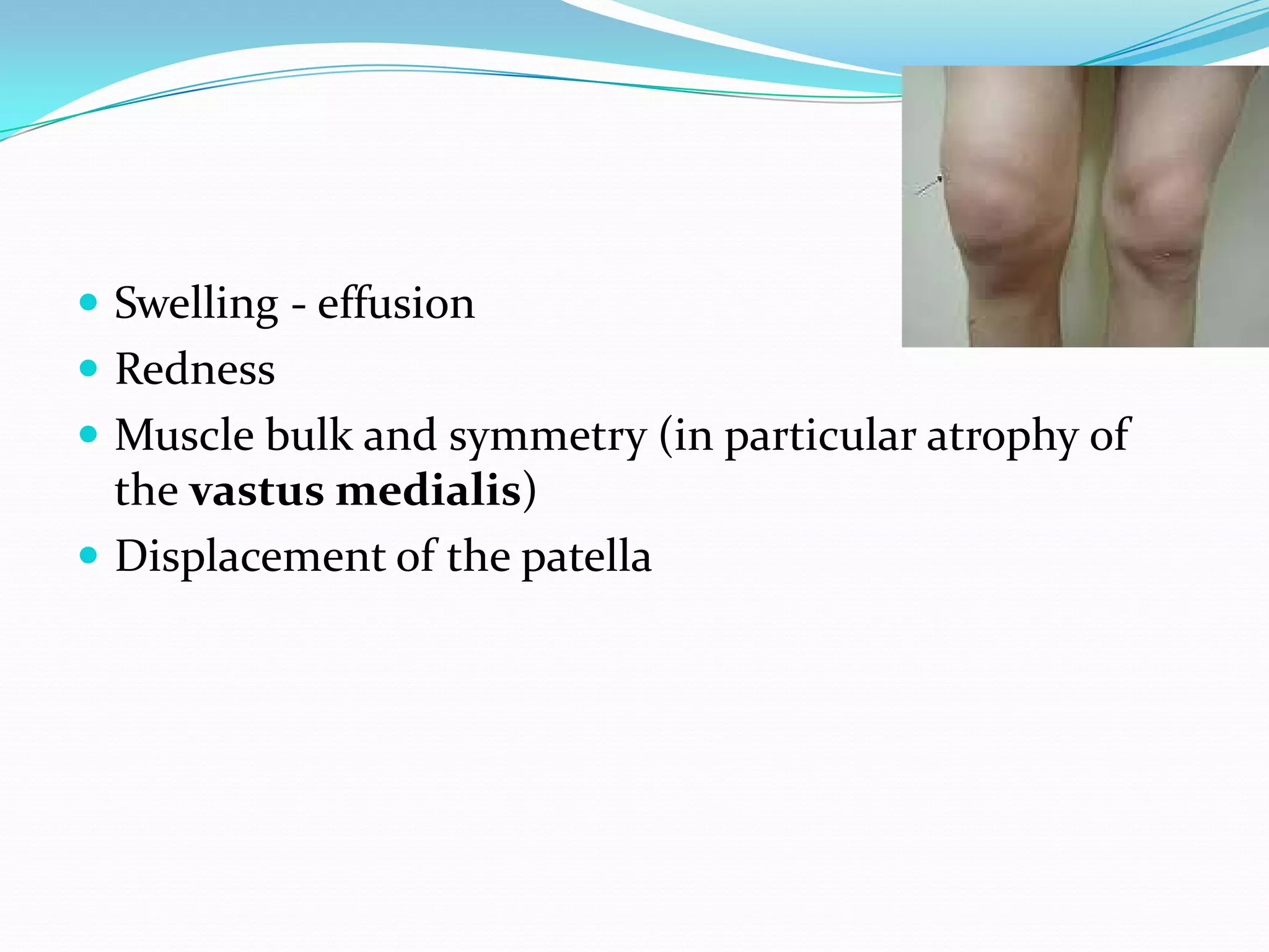 Knee examination | PDF