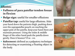 Knee examination | PDF