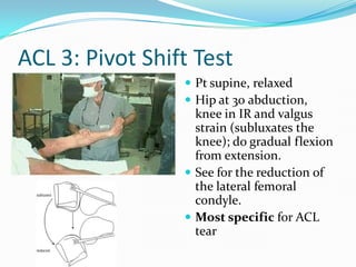 Knee examination | PDF