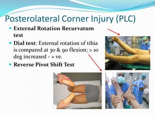 Knee examination | PDF
