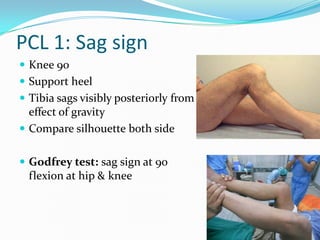 Posterior Sag Test