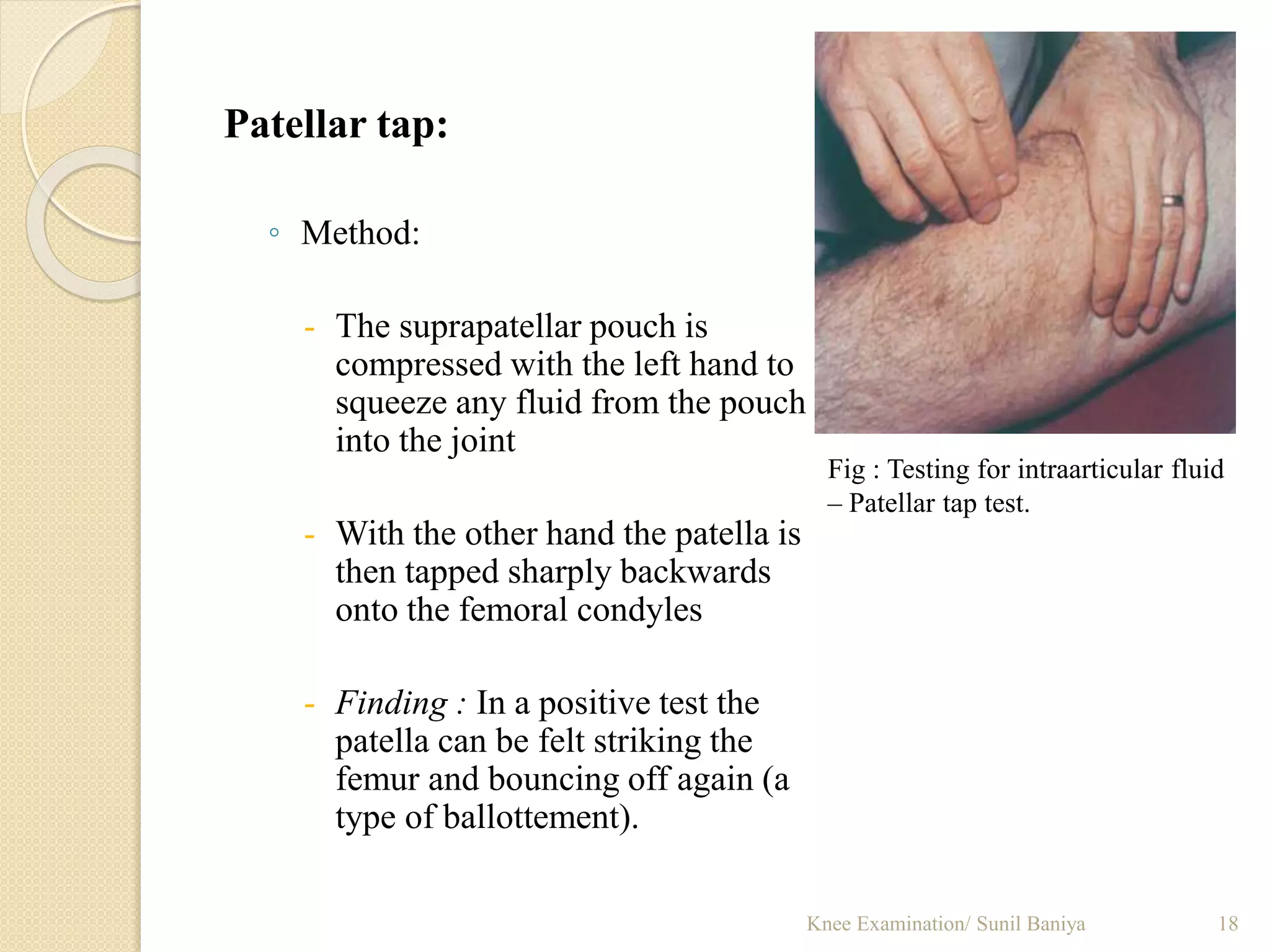 Knee examination | PPTX