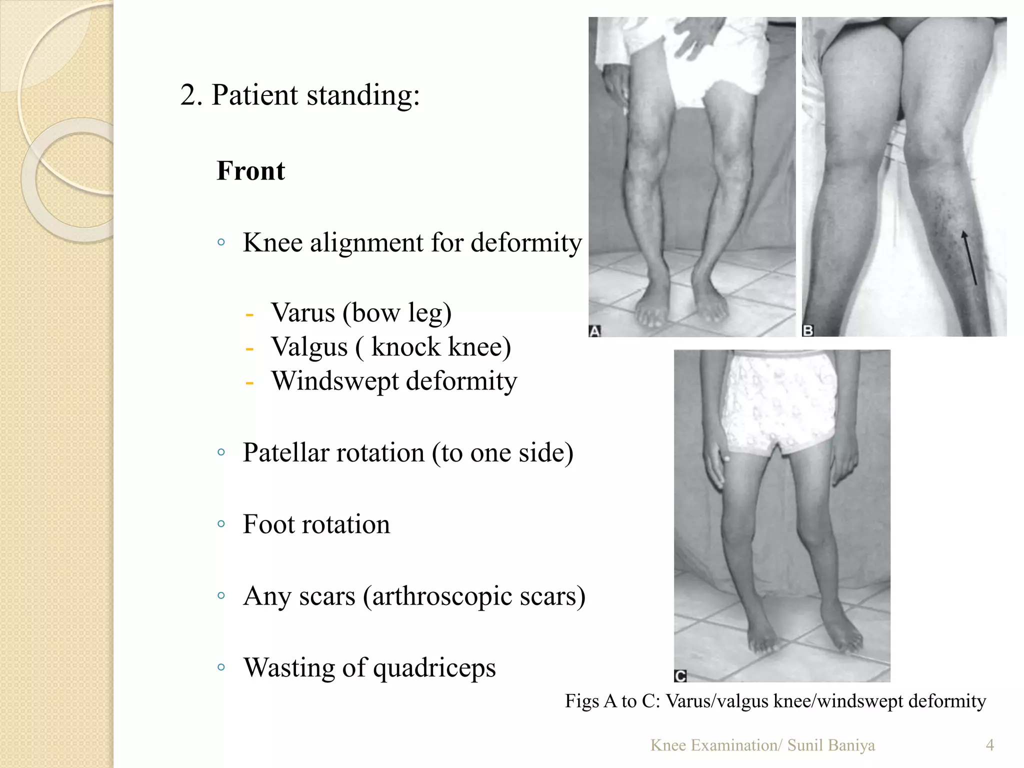 Knee examination | PPTX