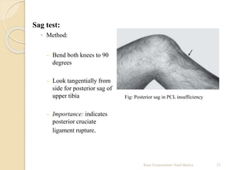 Knee examination | PPTX