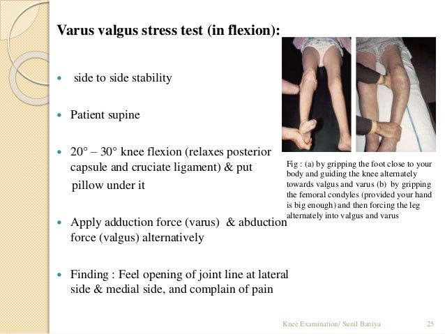 Knee examination