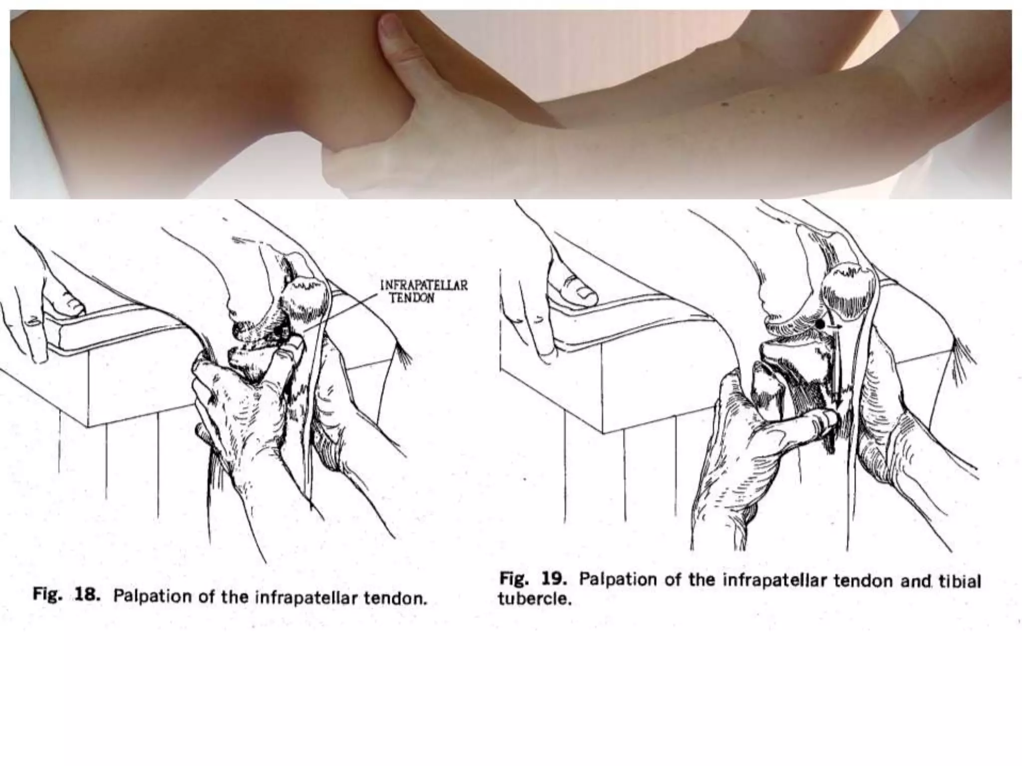 Knee examination | PPTX