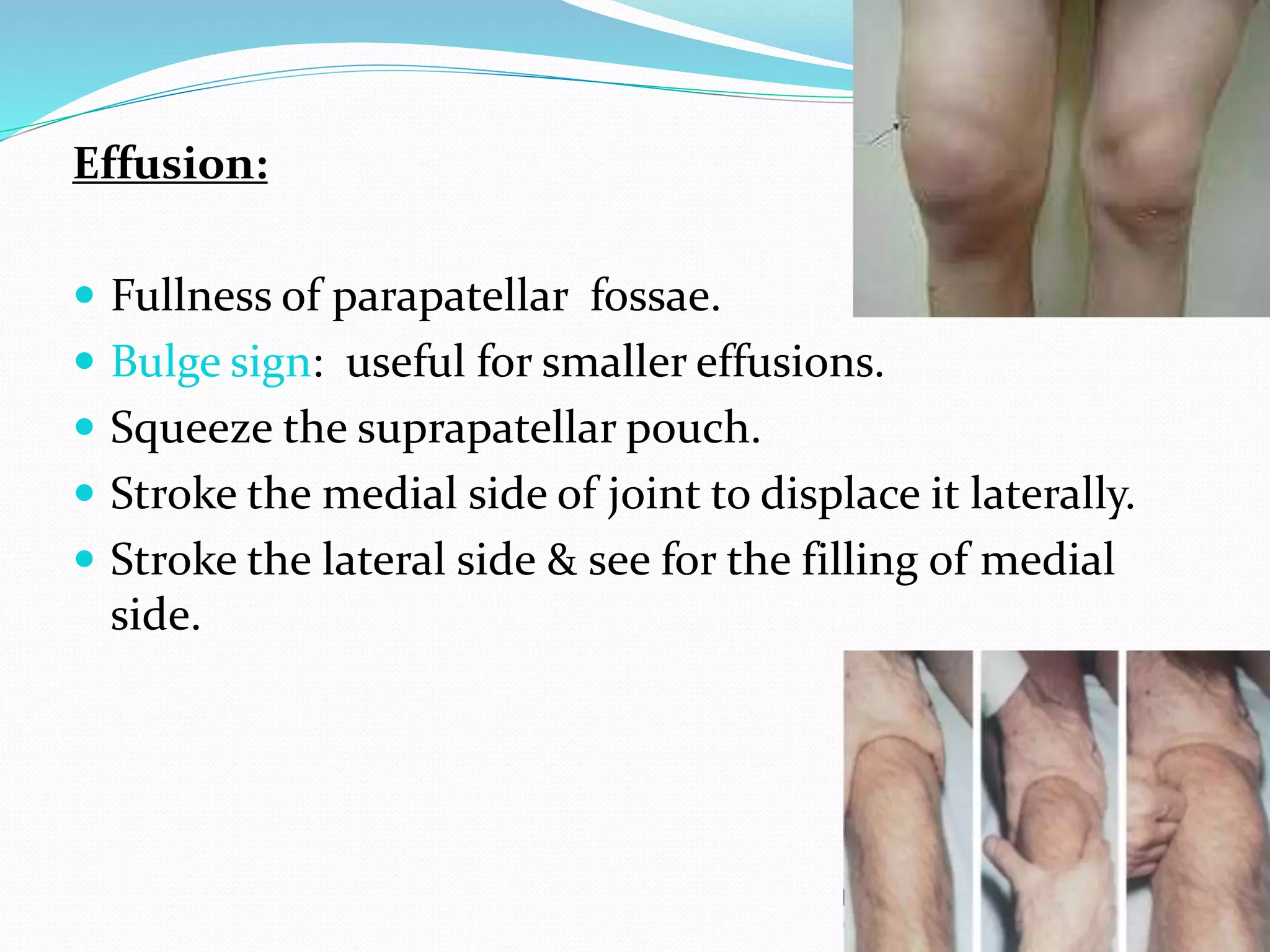 Knee examination | PPTX