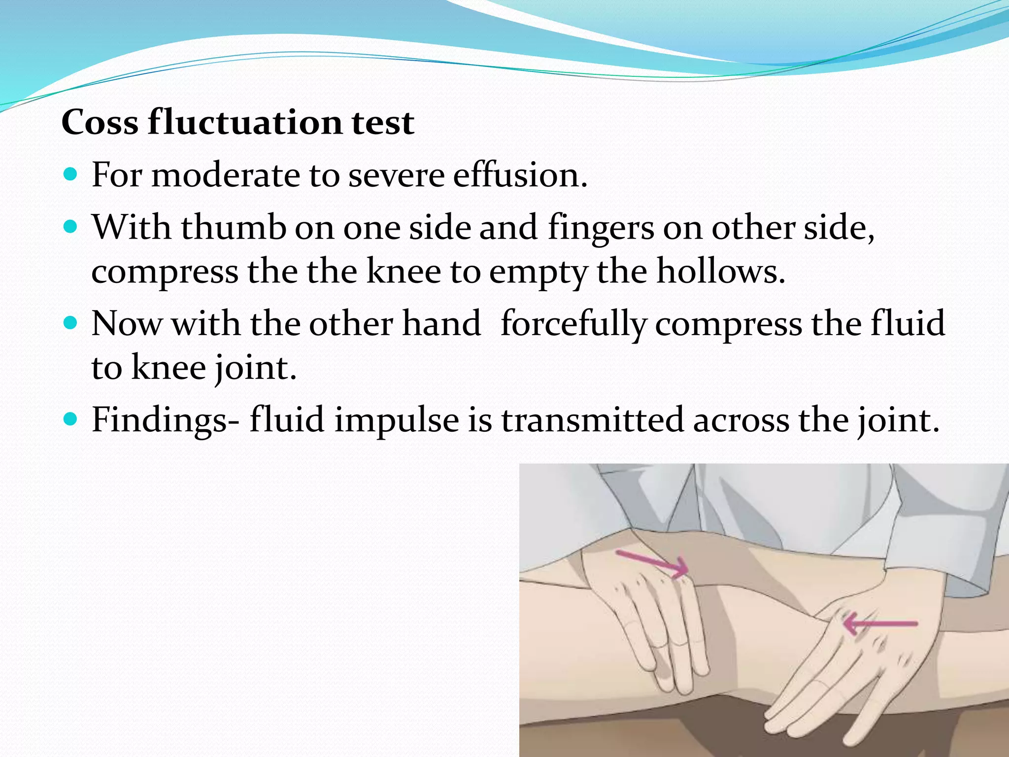 Knee examination | PPTX