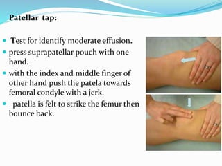 Knee examination | PPT