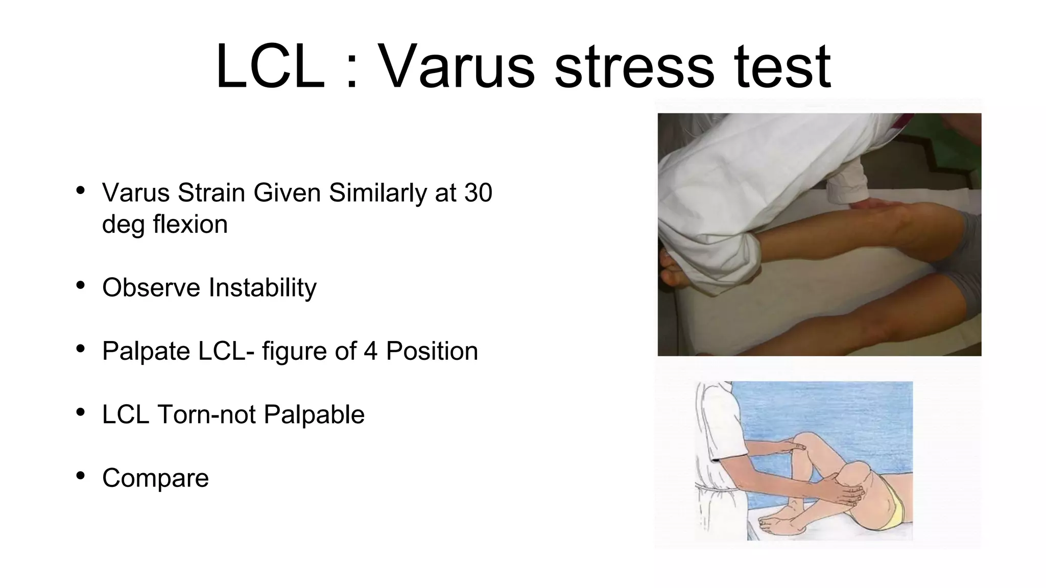 Knee examination | PPTX