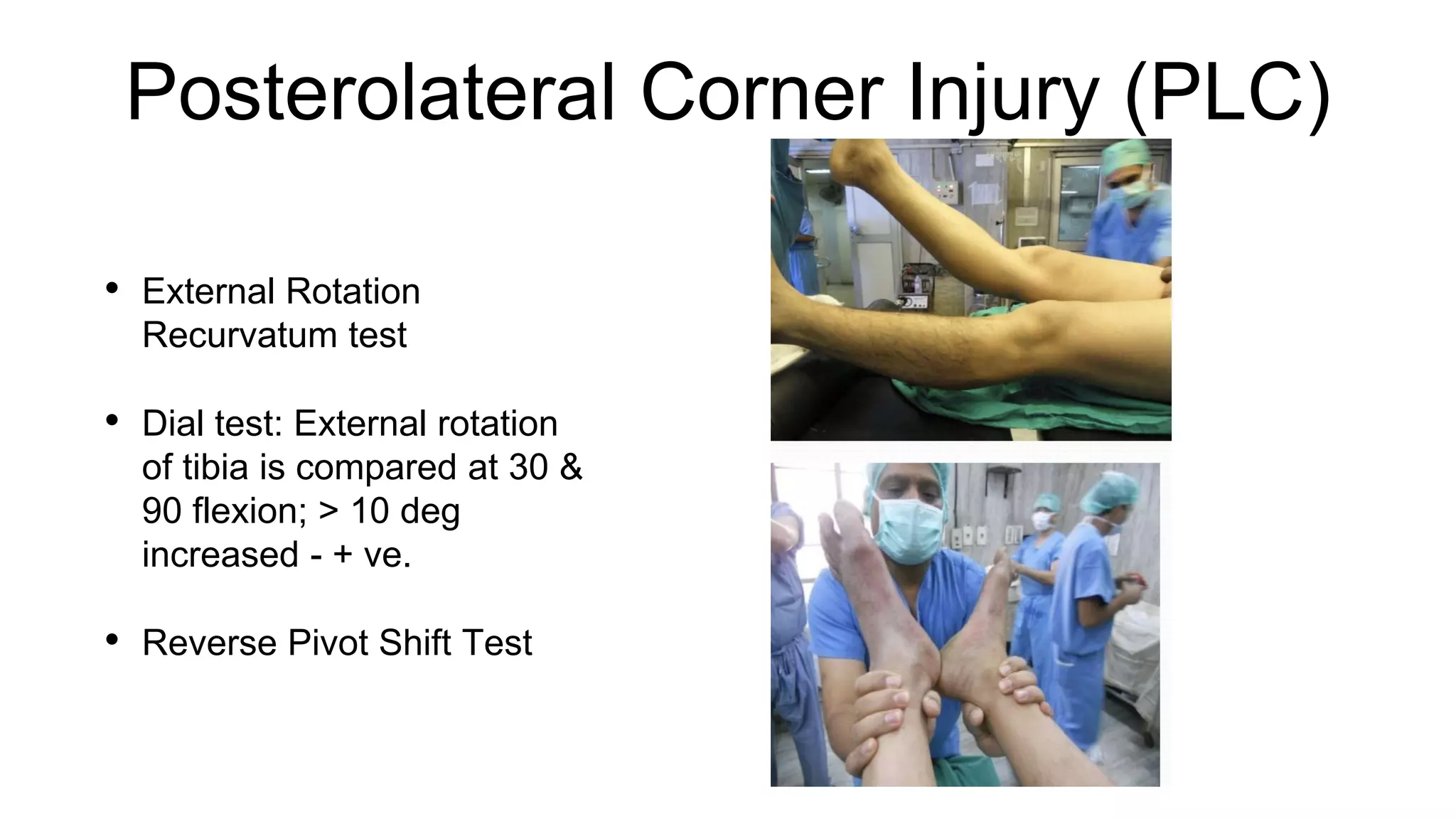 Knee examination | PPTX