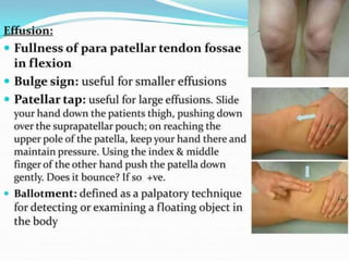 Examination of knee joint in emergency department | PPTX