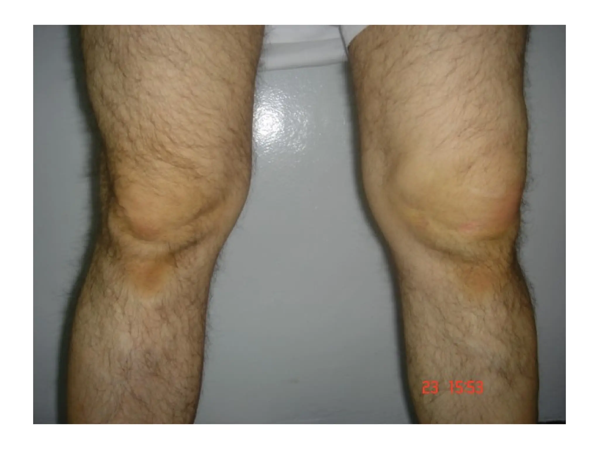 MSK Module Knee Examination in Orthopedics.ppt | Free Download