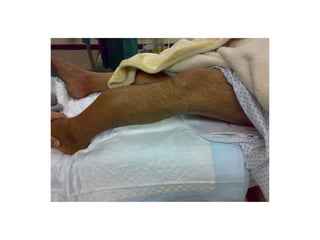 MSK Module Knee Examination in Orthopedics.ppt