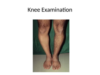 MSK Module Knee Examination in Orthopedics.ppt