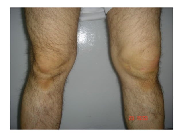 Msk Module Knee Examination In Orthopedics Ppt