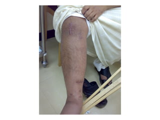MSK Module Knee Examination in Orthopedics.ppt