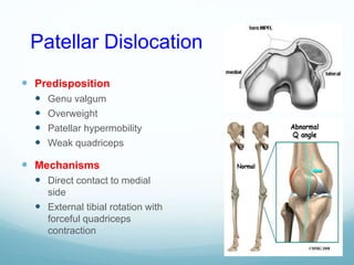 Knee SPORTS INJURIES I Dr.RAJAT JANGIR JAIPUR | PPTX