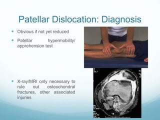 Knee SPORTS INJURIES I Dr.RAJAT JANGIR JAIPUR | PPTX