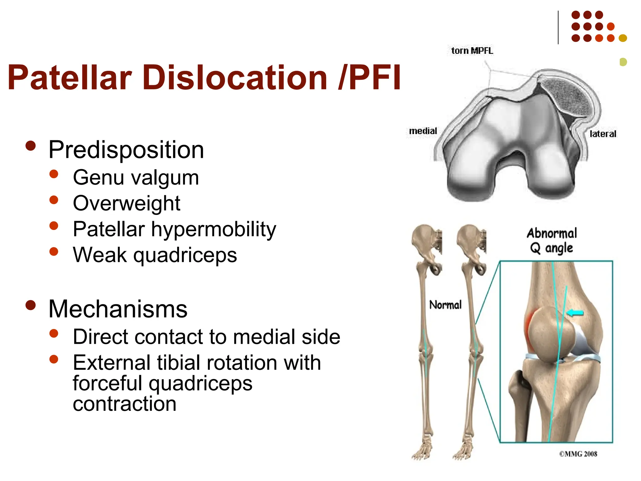KNEE INJURIES excellent slides to go.ppt