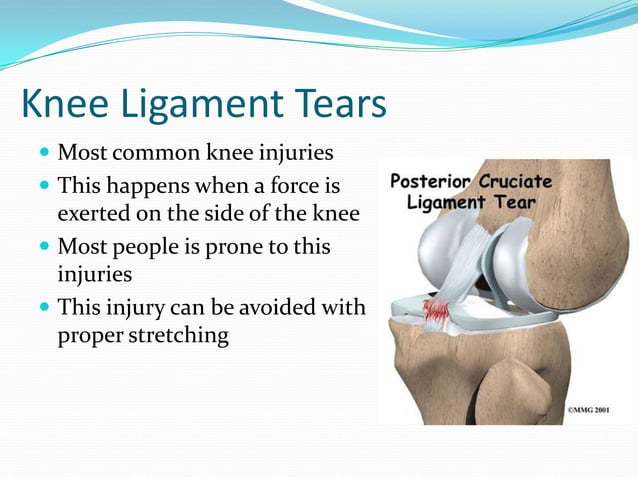 Knee Injury[3] | PPT
