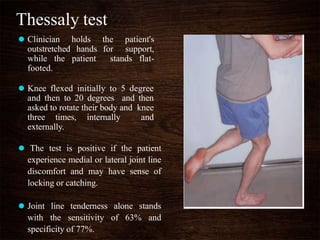 Knee instability | PPTX