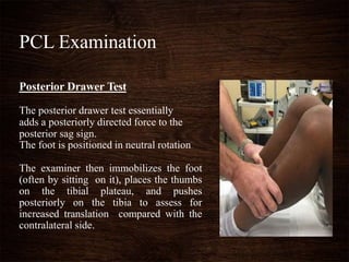 Posterior Sag Test 90 90