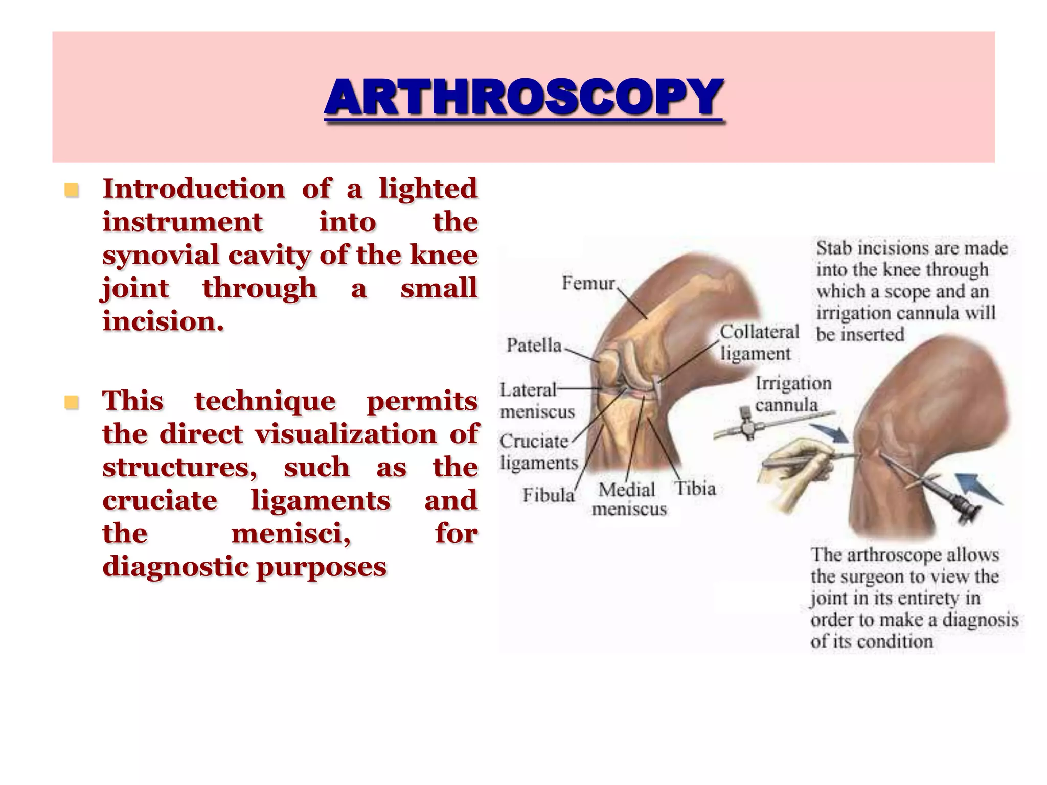 Anatomy of the Knee Joint | PPTX