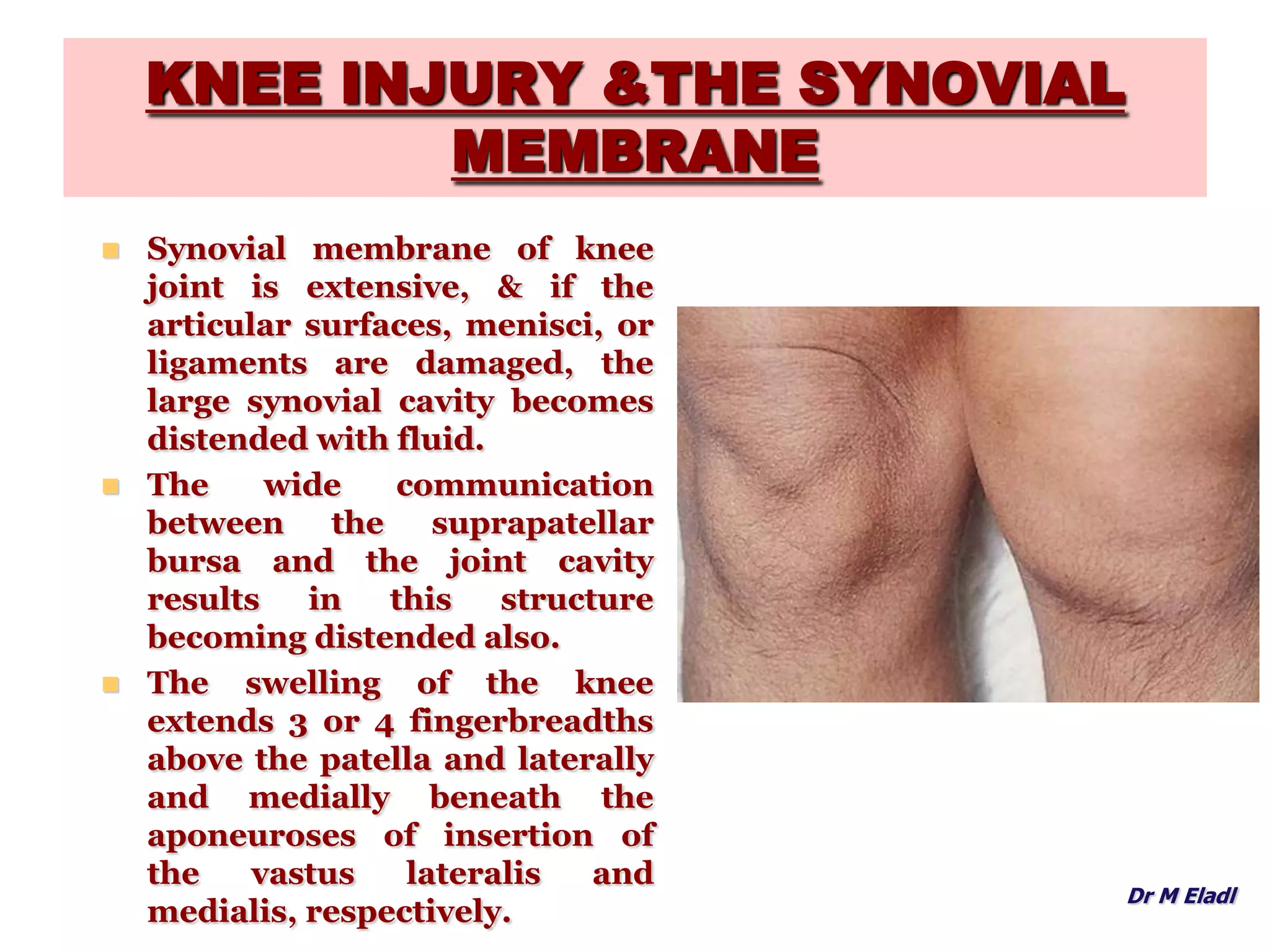 Anatomy of the Knee Joint | PPTX