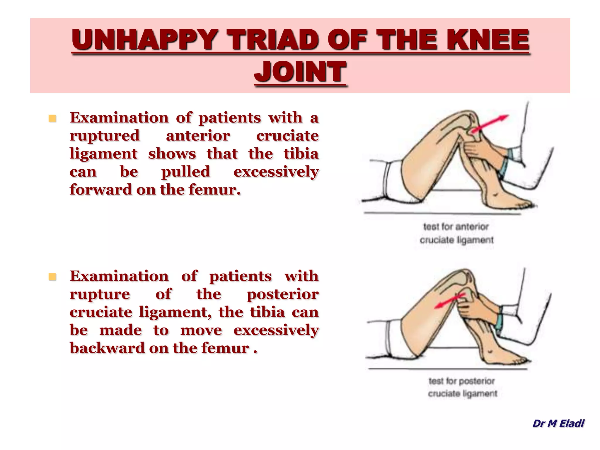 Anatomy of the Knee Joint | PPTX