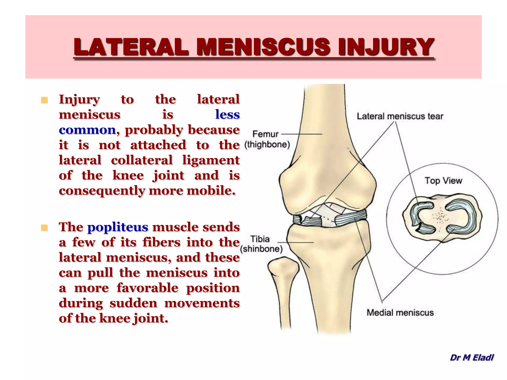 Anatomy of the Knee Joint | PPTX
