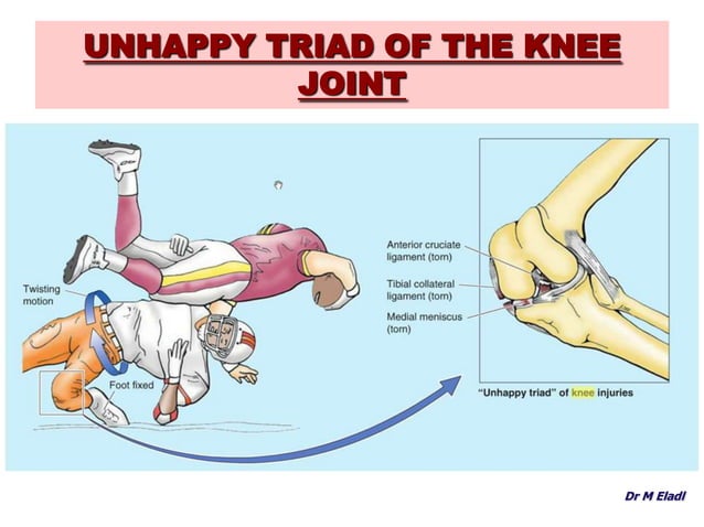 Anatomy of the Knee Joint | PPTX