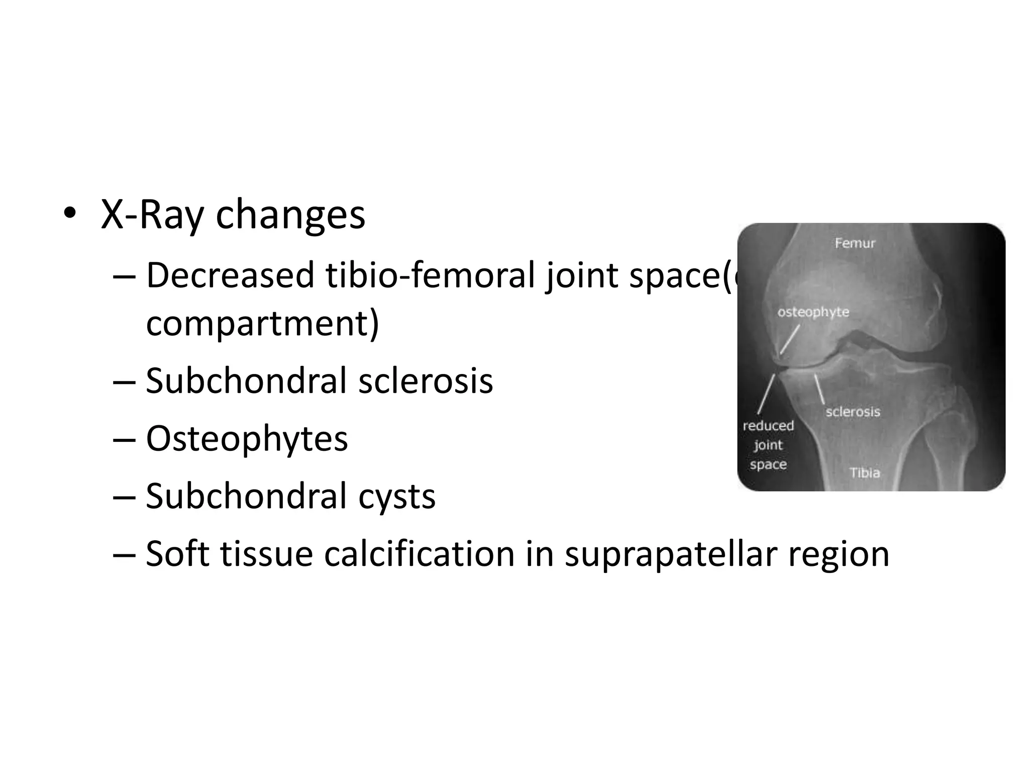 Anatomy and clinical importance of knee joint | PPTX