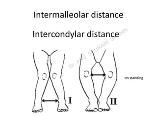 Examination of the Knee joint | PPTX
