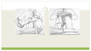 Knee Joint Sports Physical Therapy Anatomy of Knee, Common injuries in ...