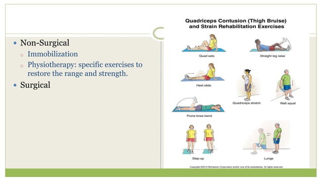 Knee Joint Sports Physical Therapy Anatomy of Knee, Common injuries in ...