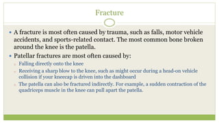 Knee Joint Sports Physical Therapy Anatomy of Knee, Common injuries in ...